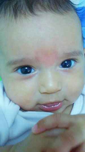 Marca de coração na testa também aparece em bebê do DF